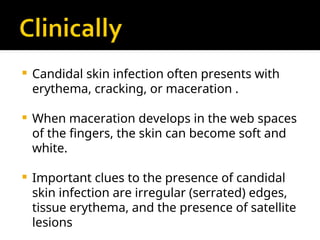Detailed notes on Fungal Skin Infections.ppt