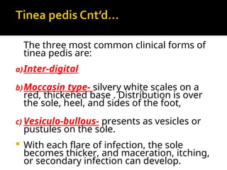 Detailed notes on Fungal Skin Infections.ppt