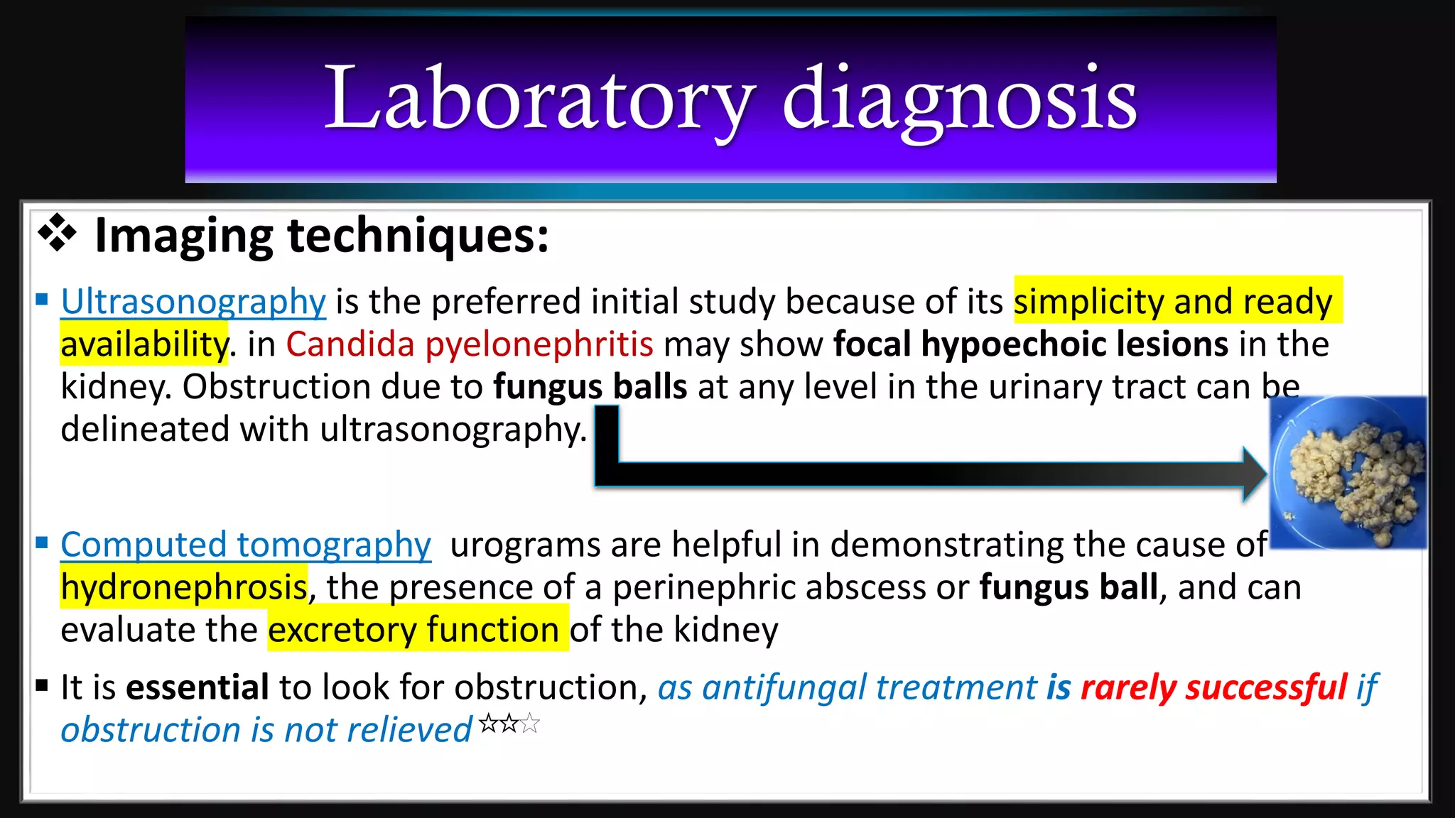 Fungal Urinary Tract Infections by YF.pdf