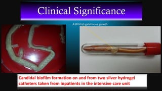 Fungal Urinary Tract Infections by YF.pdf