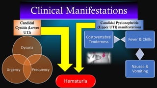 Fungal Urinary Tract Infections by YF.pdf