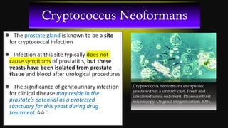 Fungal Urinary Tract Infections by YF.pdf