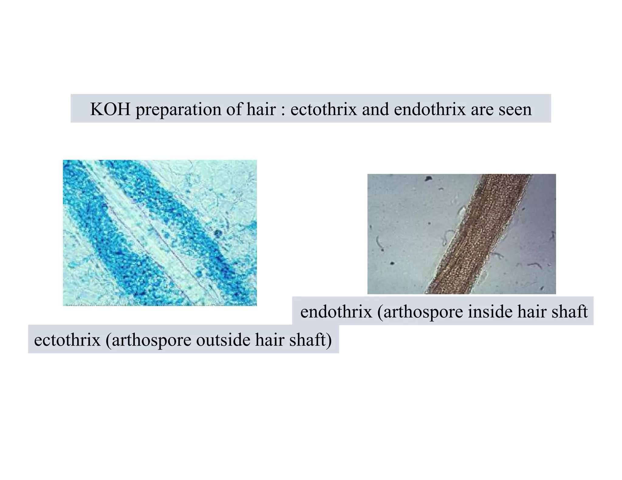 Fungal zoonoses | PDF
