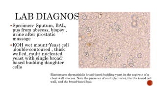 fungal zoonosis ( zoonnesis ) Fungal disease | PPTX