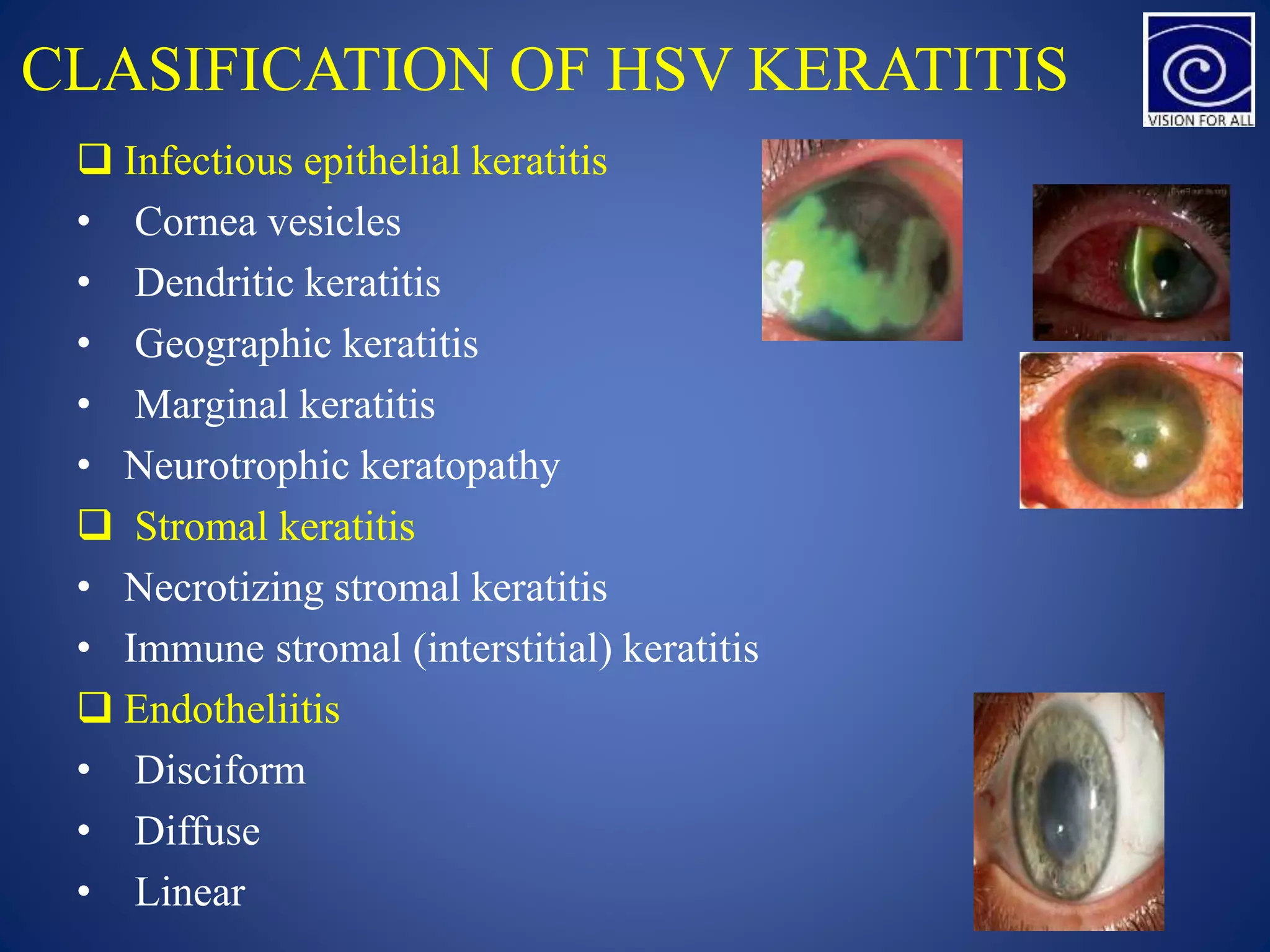 RAMJI PANDEY BY Fungel keratitis workup protocol | PPT
