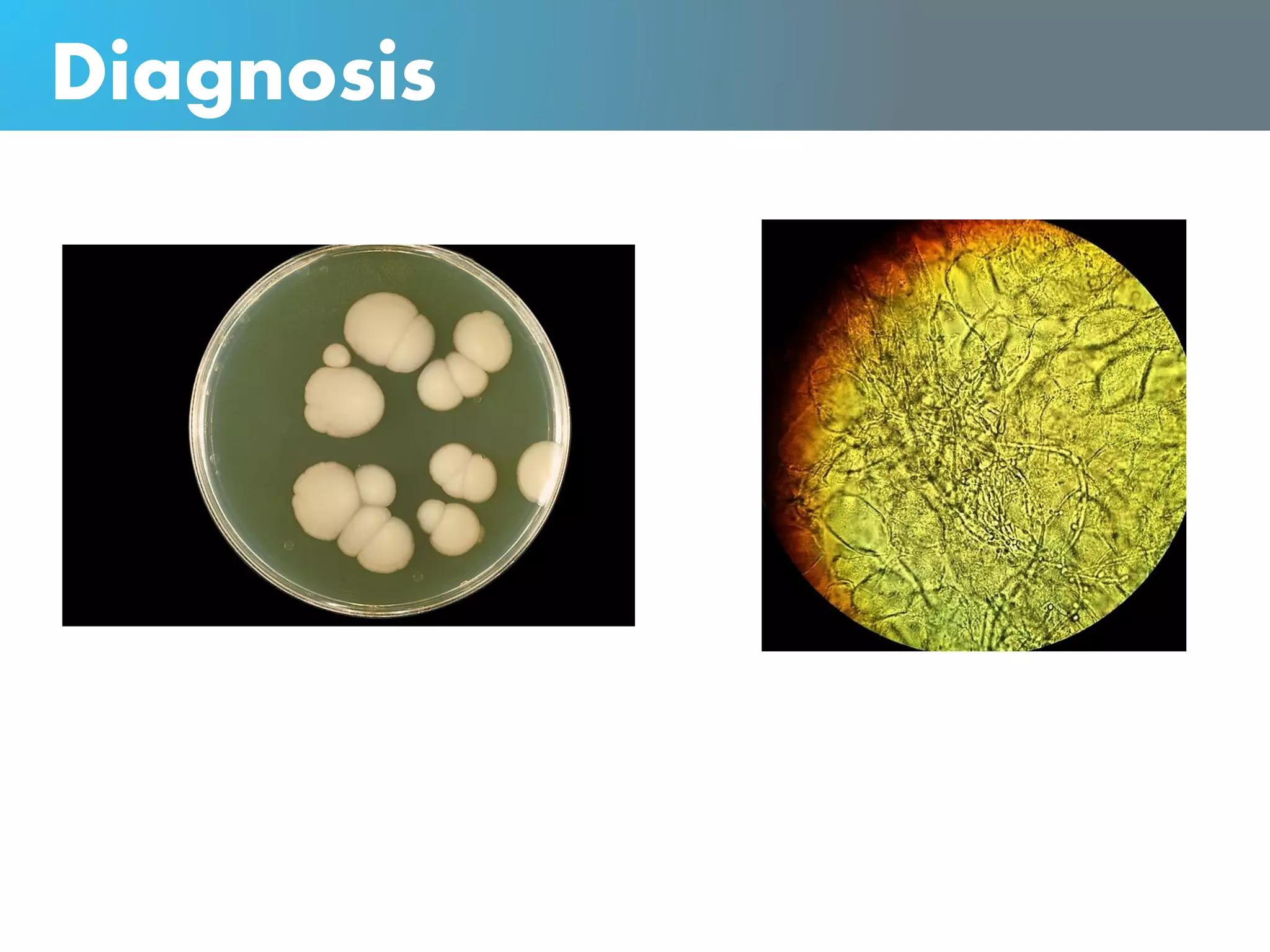 Fungi: Yeast, Filamentous and Dimorphic | PDF