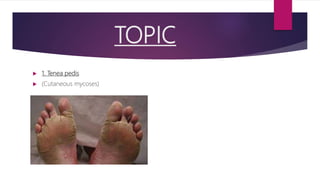 ATHLETE'S FOOT [TENEA PEDIS] FUNGI | PPTX
