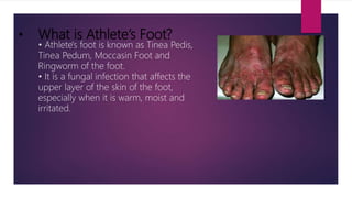 ATHLETE'S FOOT [TENEA PEDIS] FUNGI | PPTX