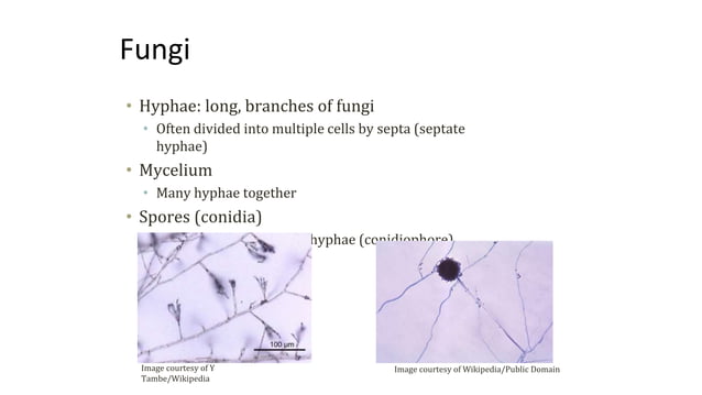 Fungi.pptx - systemic and opportunistic fungi | PPTX | Infectious Diseases | Diseases and Conditions