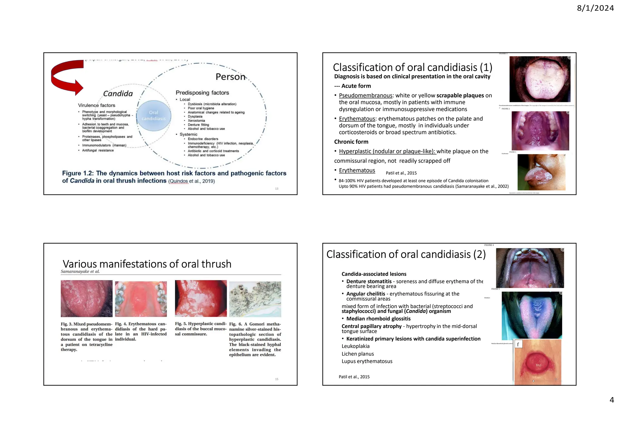 Lecture on Fungi in Relevance to Dentistry.pdf