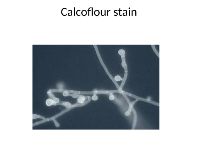 Mycology introduction Fungi-introduction | PPT