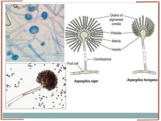 Identification of Fungi | PPTX