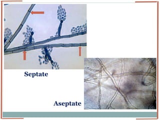 Identification of Fungi | PPTX