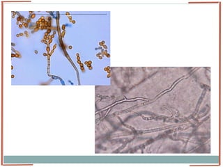 Identification of Fungi | PPTX