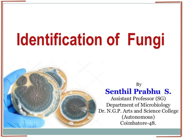 Identification of Fungi