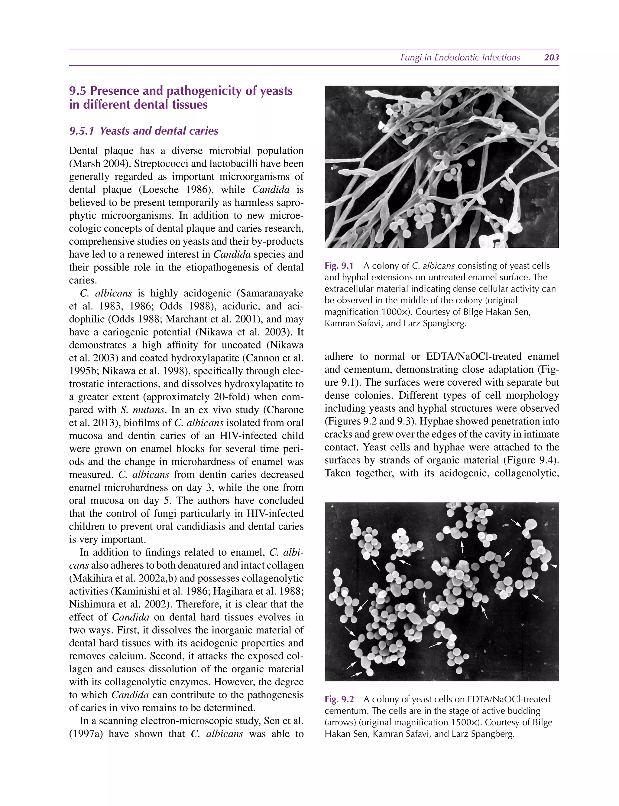 Fungi in Endodontic Infections.pdf