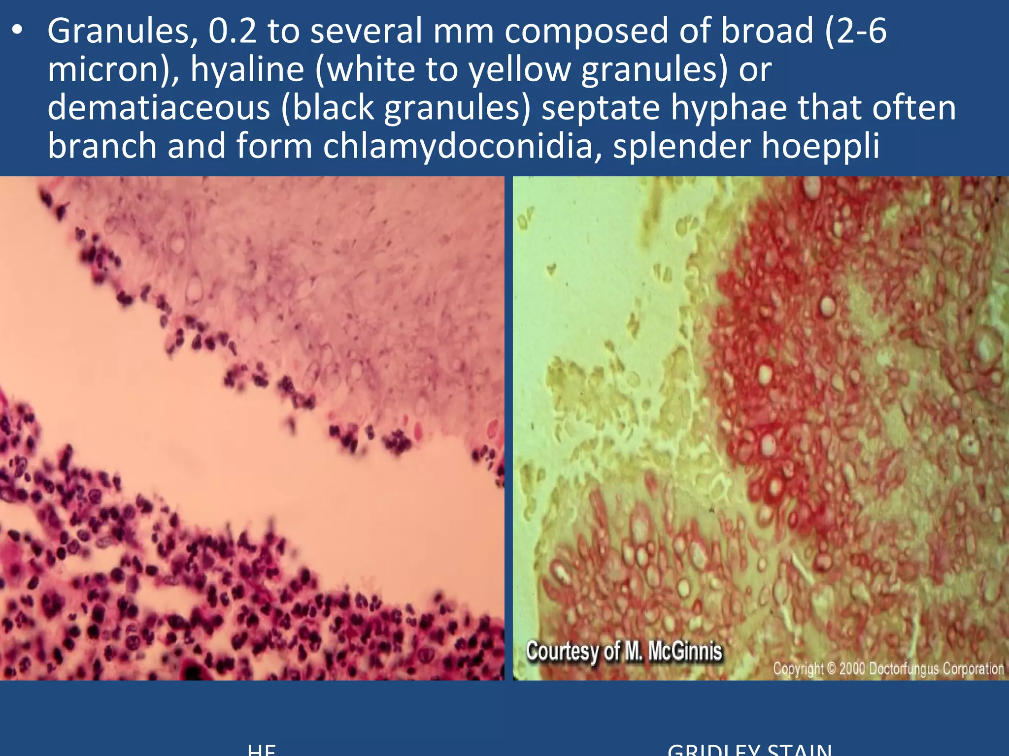 Fungi in tissue sections | PPT
