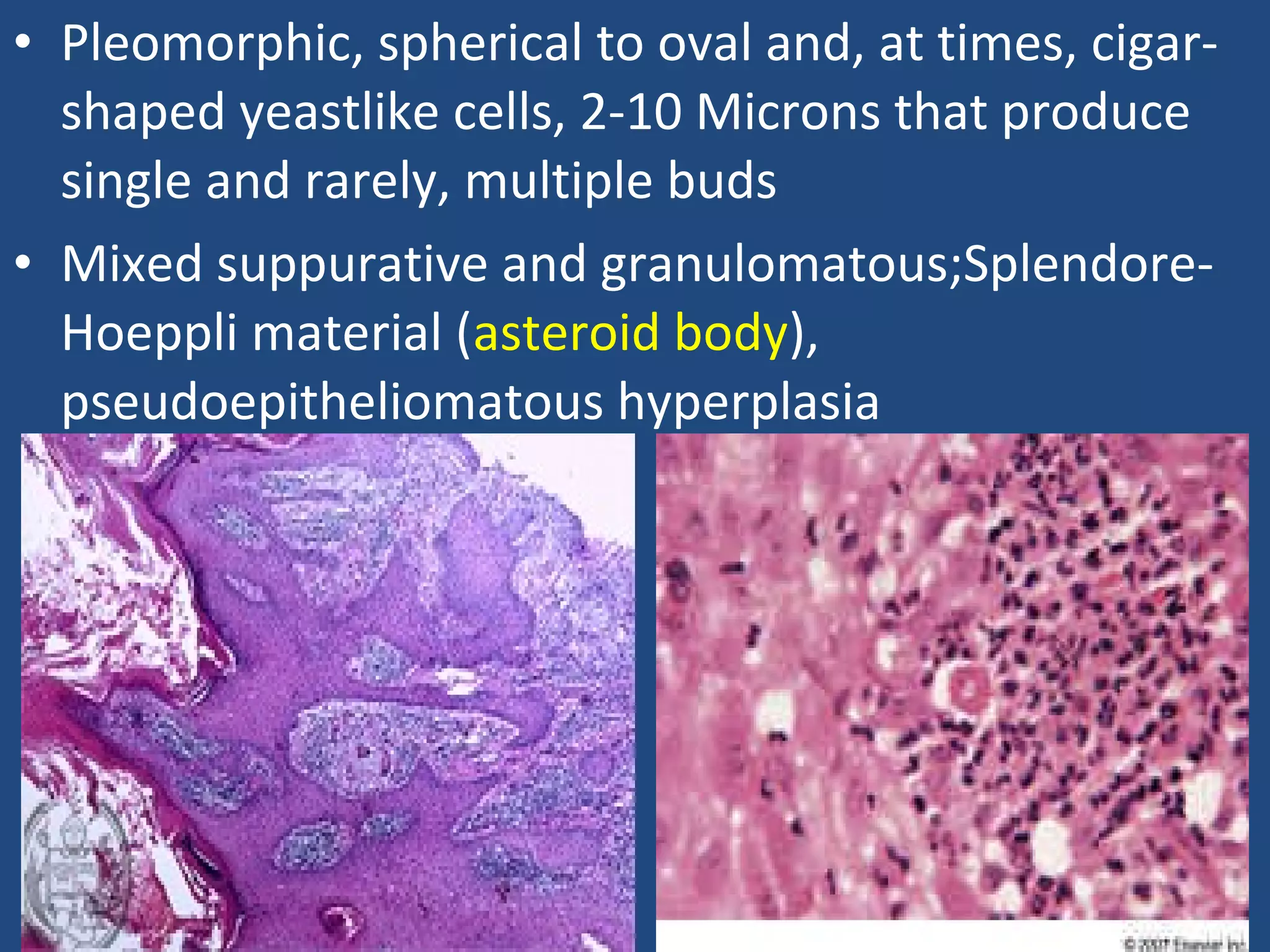Fungi in tissue sections | PPT