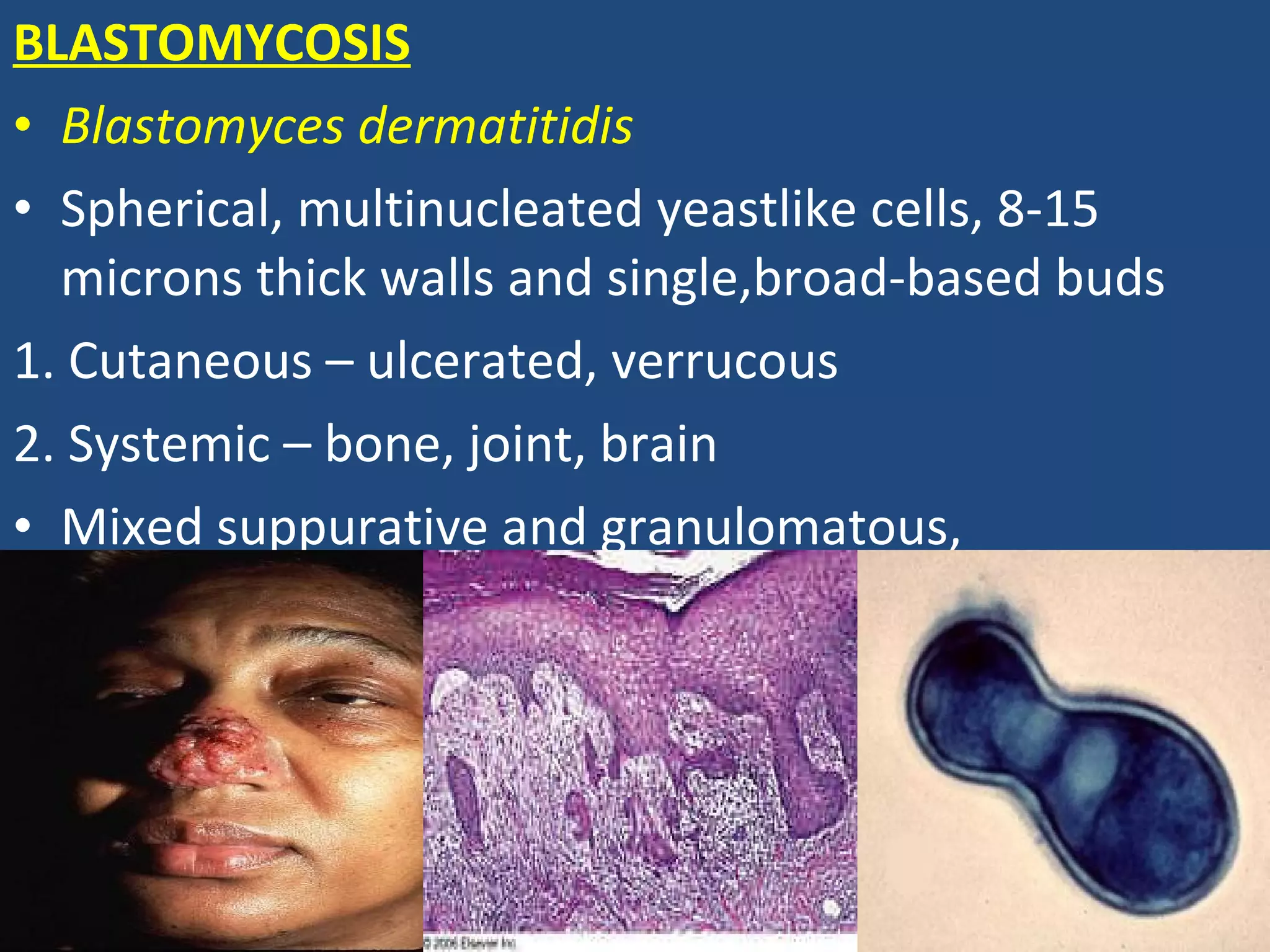 Fungi in tissue sections | PPT