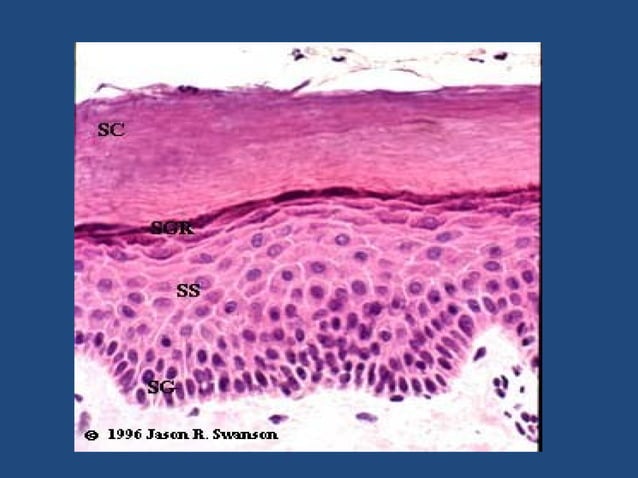 Fungi in tissue sections | PPT | Skin and Dermatology | Diseases and ...