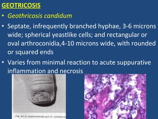 Fungi in tissue sections | PPT