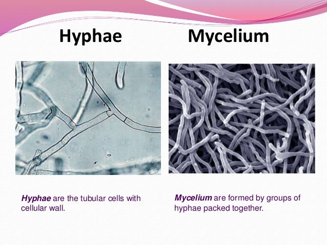 Fungi kingdom CLIL (Natural sciences) 1º ESO