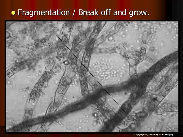 Fungi Reproduction, Fungi Life Cycle Biology Lesson PowerPoint, Spore…