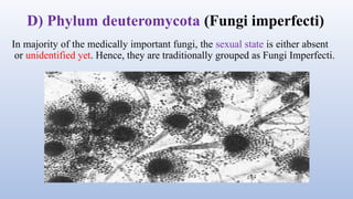 Medical Mycology, Infection or Disease Part-1.pptx