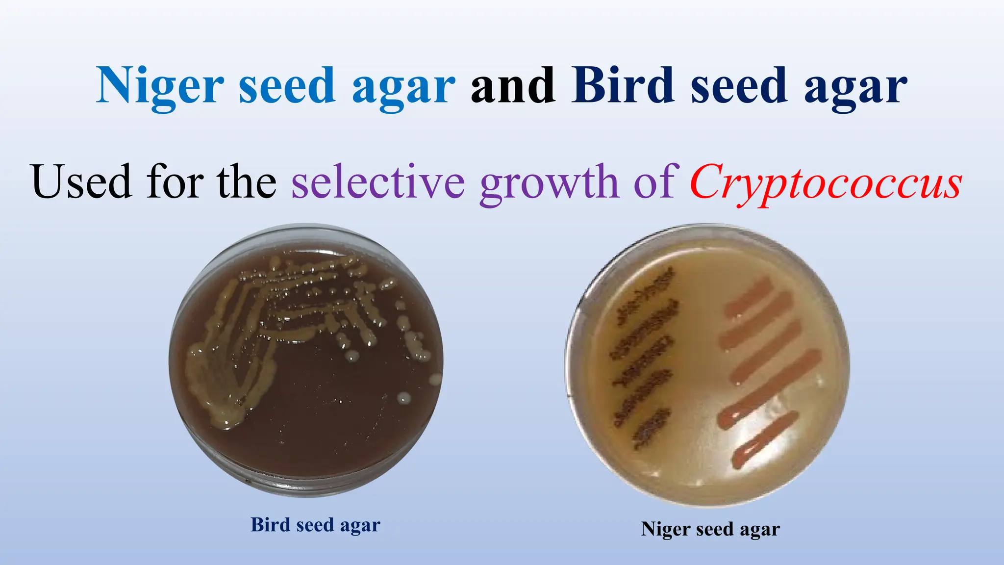 Laboratory Diagnosis of Mycology-II, microscopy, staining, culture ...