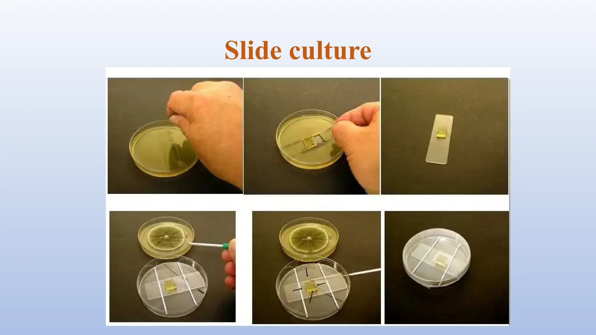 Laboratory Diagnosis of Mycology-II, microscopy, staining, culture ...