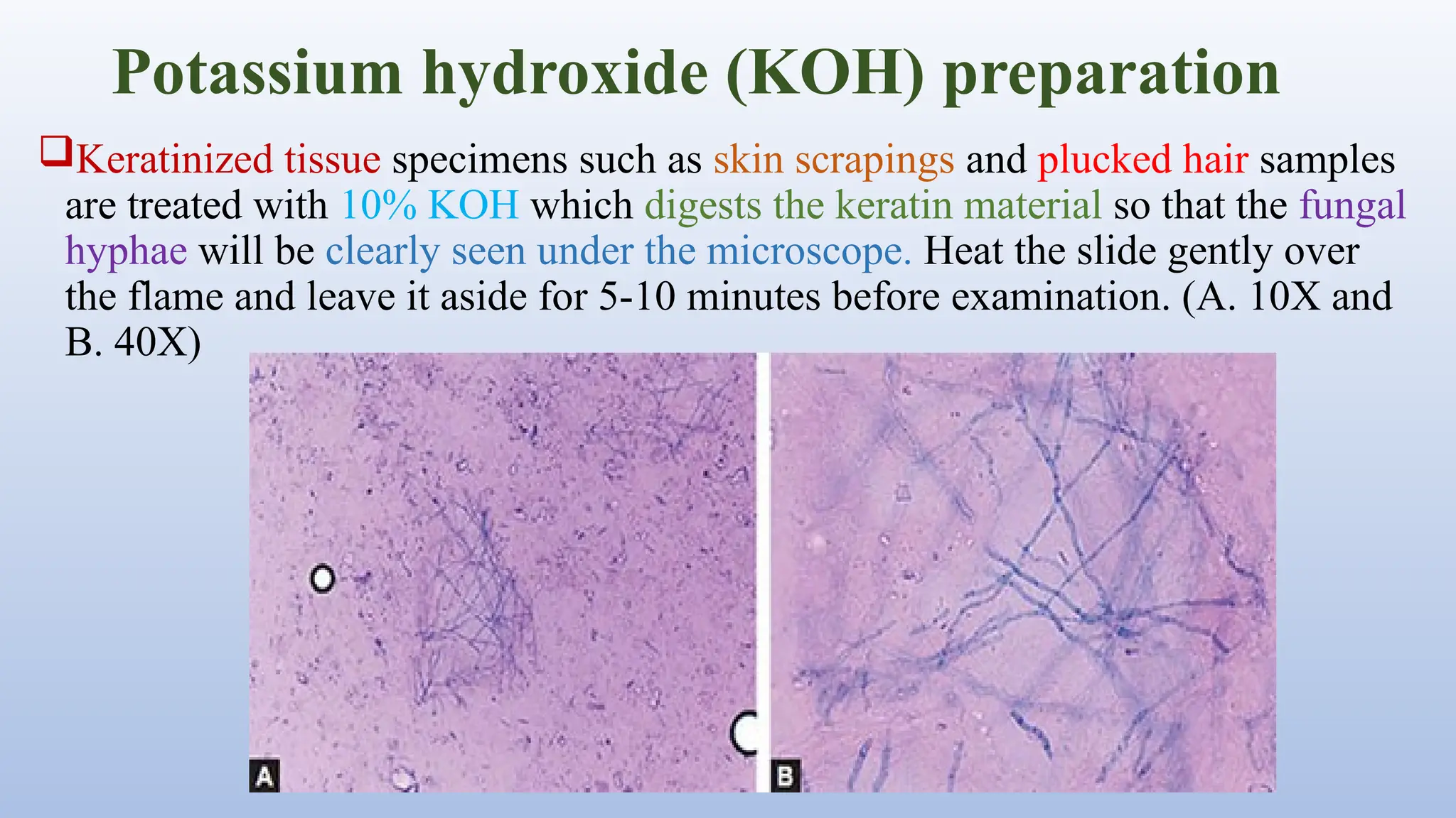 Laboratory Diagnosis of Mycology-II, microscopy, staining, culture ...