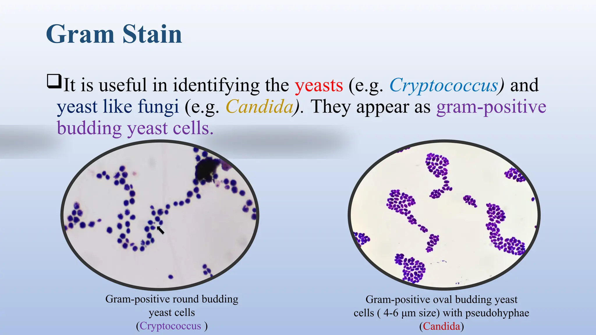 Laboratory Diagnosis of Mycology-II, microscopy, staining, culture ...