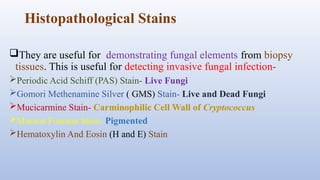 Laboratory Diagnosis of Mycology-II, microscopy, staining, culture ...