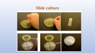 Laboratory Diagnosis of Mycology-II, microscopy, staining, culture ...