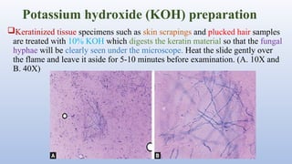 Laboratory Diagnosis of Mycology-II, microscopy, staining, culture ...