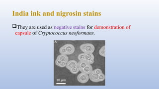 Laboratory Diagnosis of Mycology-II, microscopy, staining, culture ...