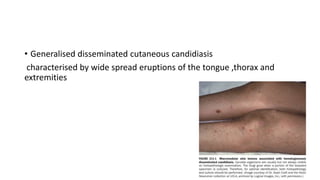 MYCOLOGY-MUCORMYCOSIS, ASPERGILLOSIS, CANDIDIASIS | PPTX