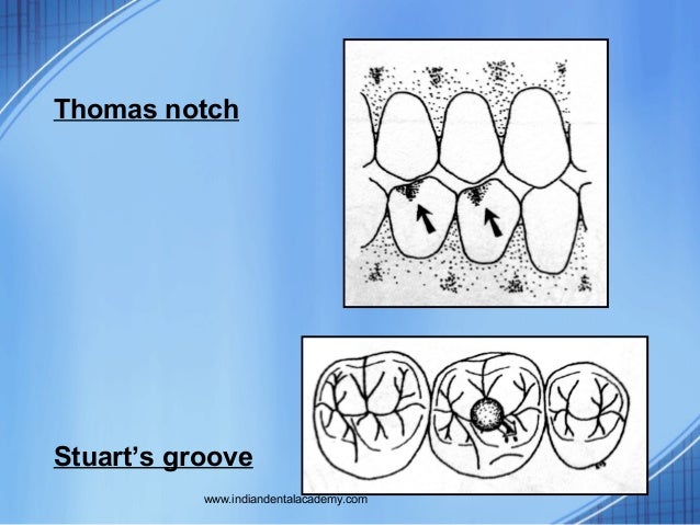 Funl occlusal wax/dental courses