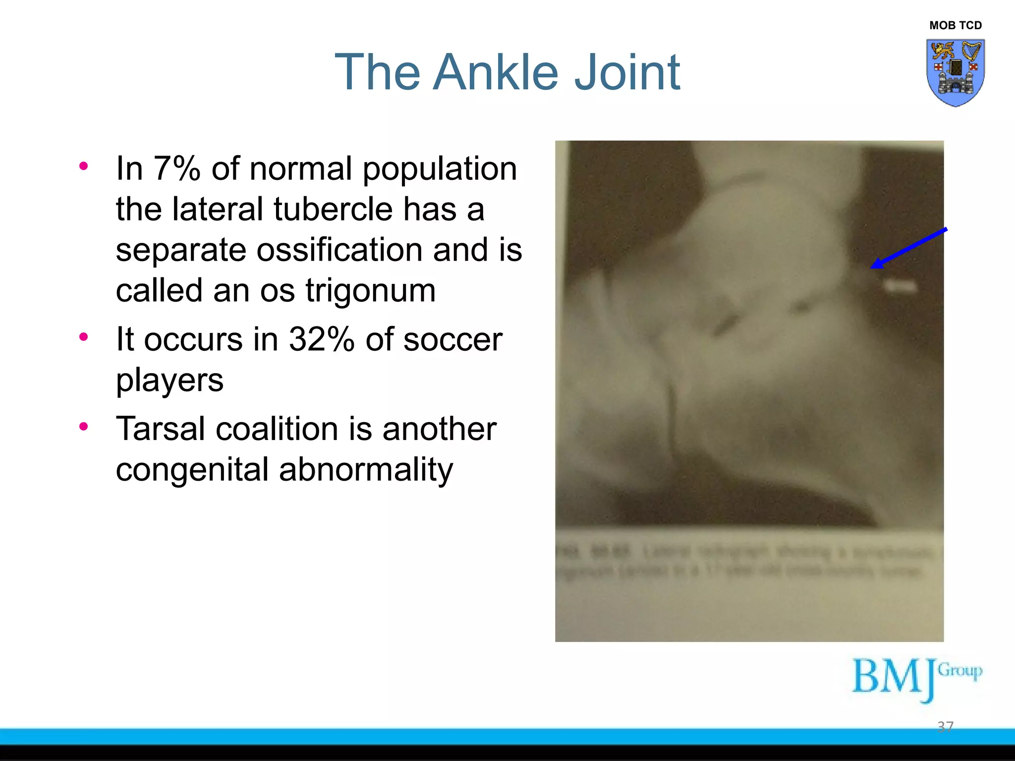 Functional anatomy of the ankle joint complex | PPT