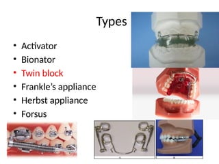 FUNTIONAL APPLIANCE and growth modification | PPTX
