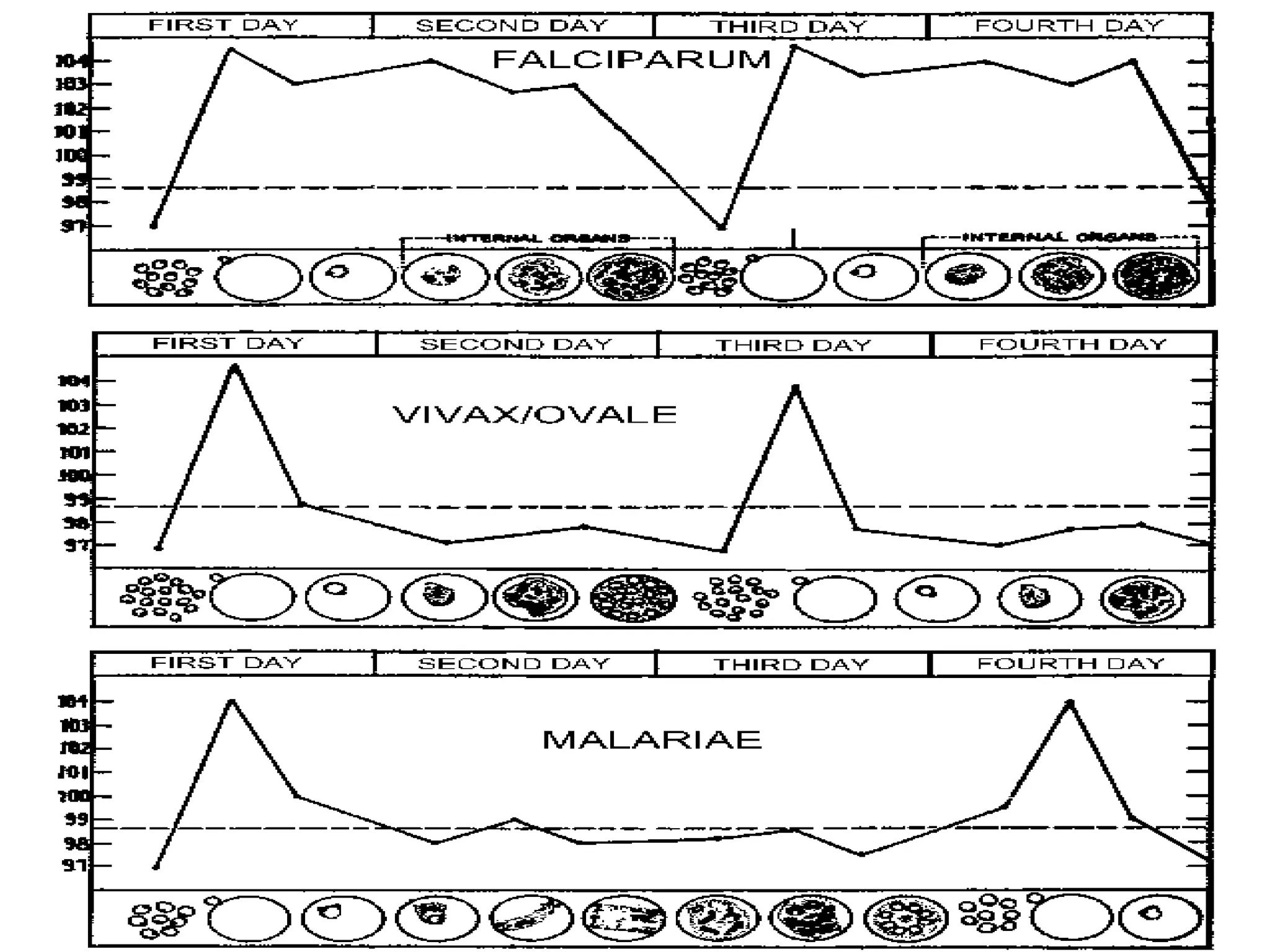 FEVER OF UNKNOWN ORIGIN - PEDIATRICS | PPTX