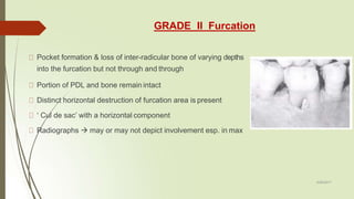 Furcation | PPTX