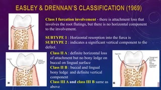 Furcation involvement and management | PPTX