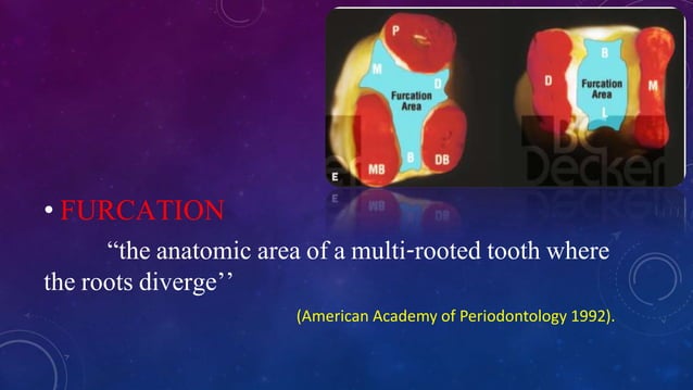 Furcation involvement and management | PPTX | Bone and Joint Conditions | Diseases and Conditions