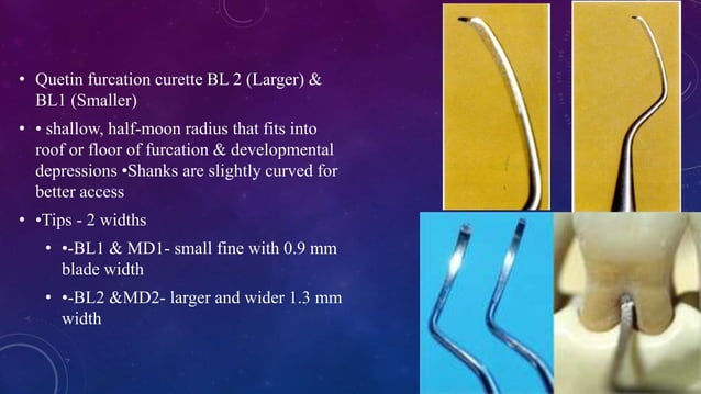 Furcation involvement and management | PPTX | Bone and Joint Conditions | Diseases and Conditions