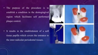 Furcation involvement and management | PPTX