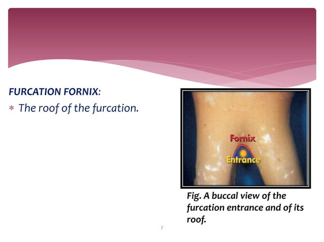 FURCATION and its classification 1 .pptx