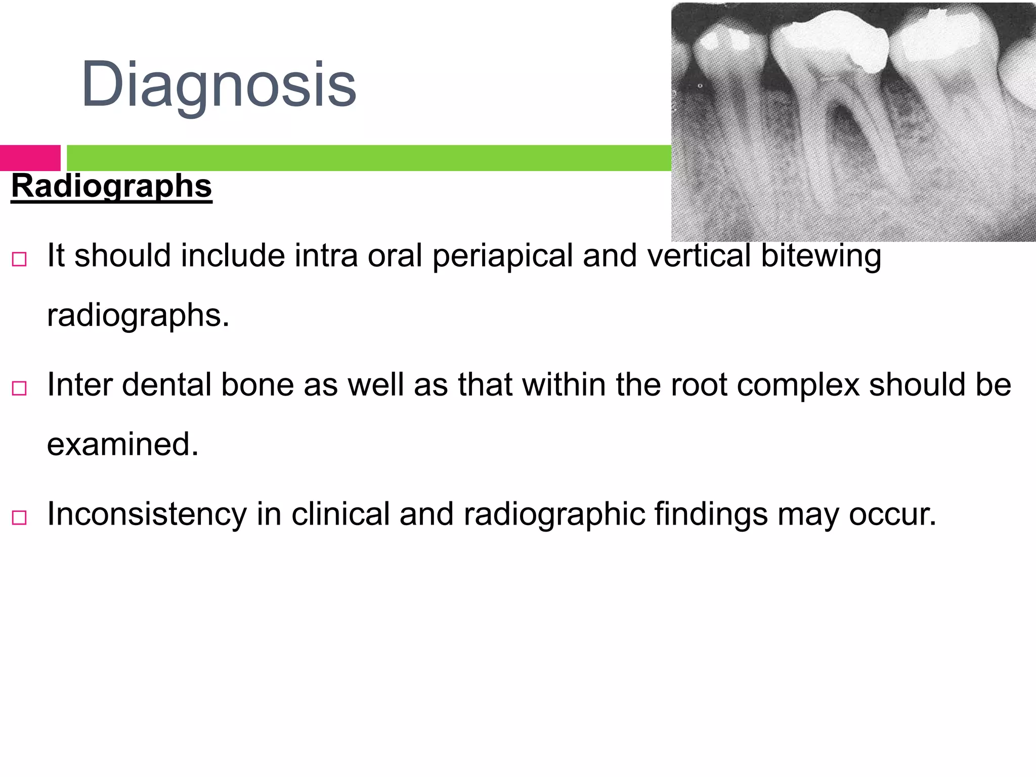 Furcation involvement | PPTX