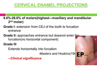Cervical Enamel Projection