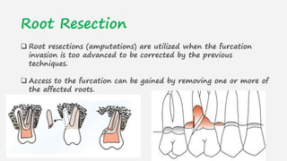 Furcation involvement-periodontology-2.pptx